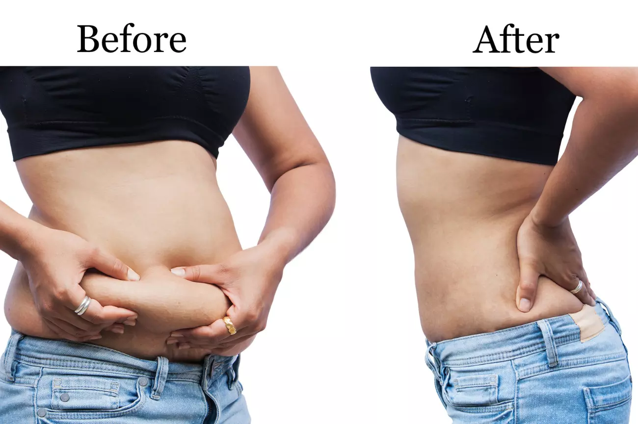 How to quickly remove belly fat?