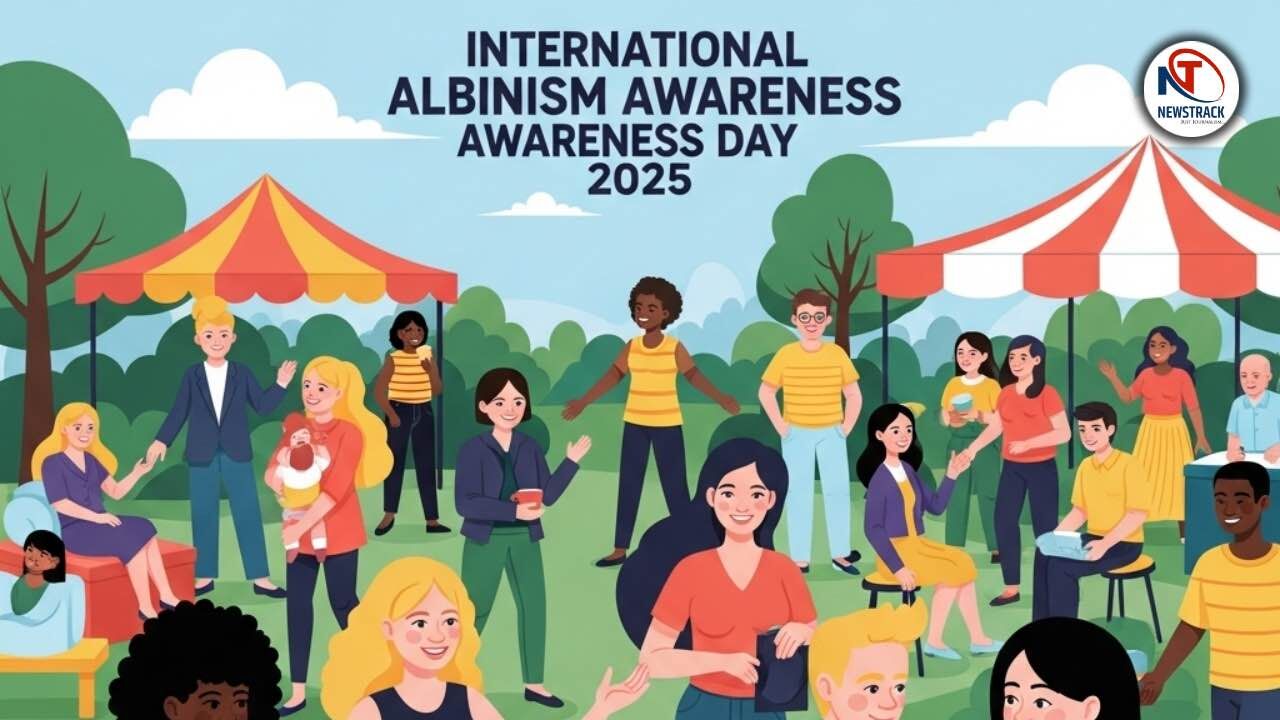 What Is International Albinism Awareness Day? What Is Its History? What ...